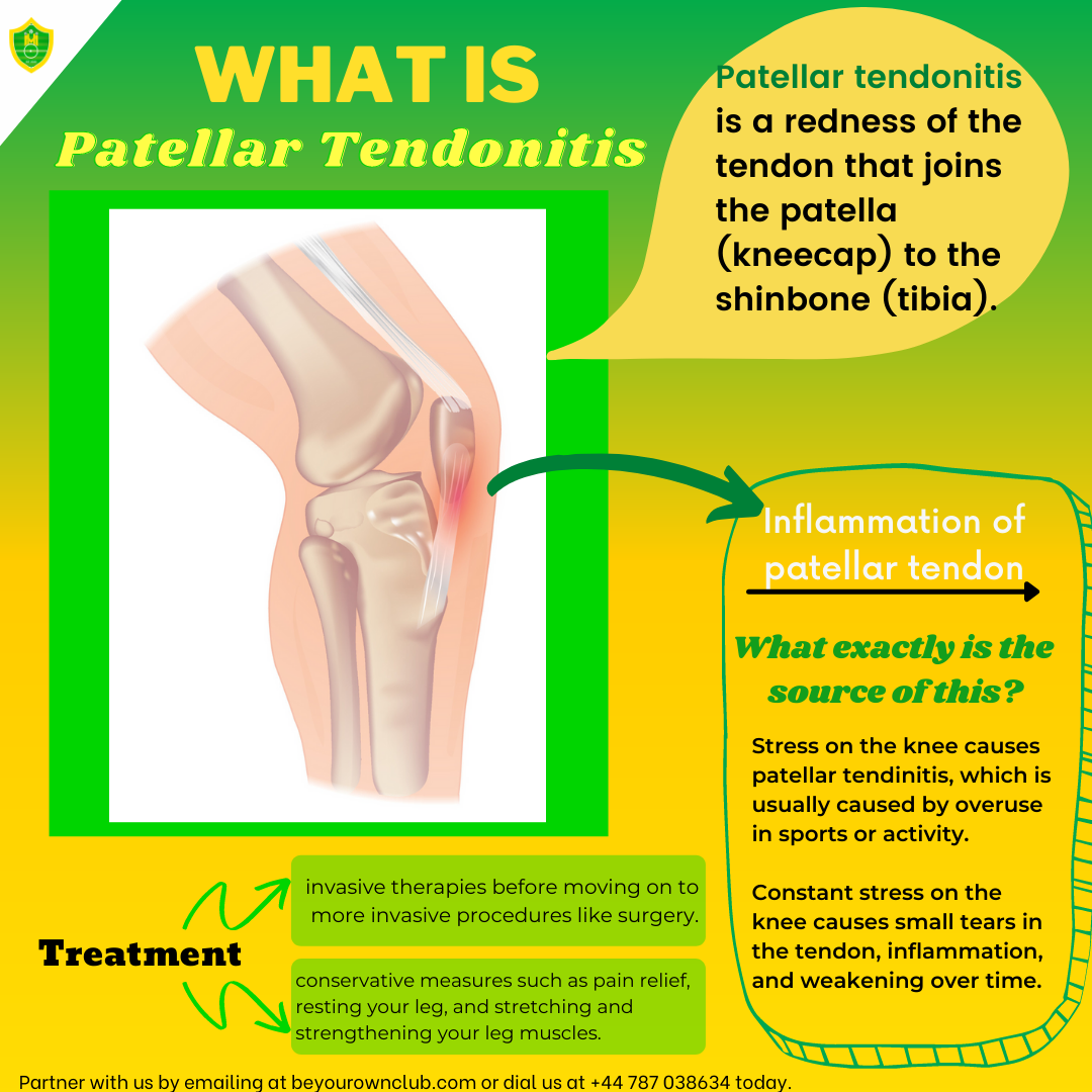 Patellar Tendonitis: Caused and Treatment - M. Hussein